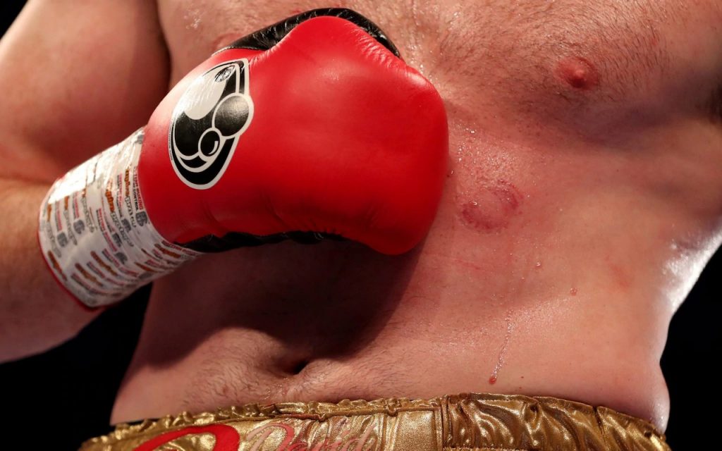 British heavyweight boxer Kash Ali disqualified for biting opponent ...